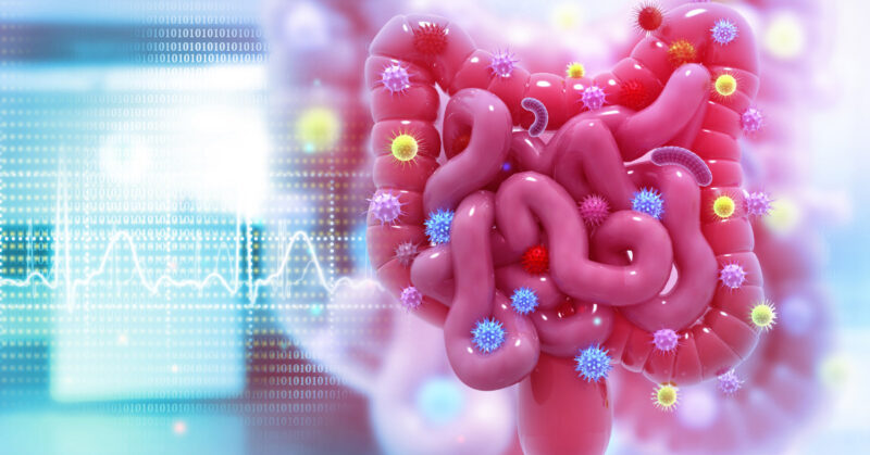 The 5 stages of colon cancer - Colon & Rectal Surgery - New York